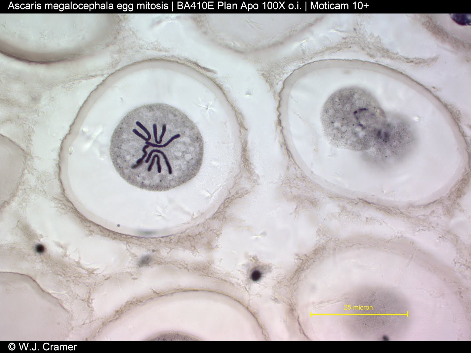 Motic Europe | Blog: How a small intestinal roundworm contributed to ...