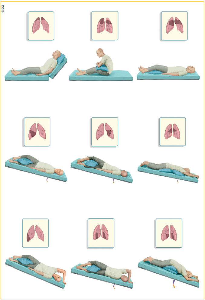 SALUD CON SENTIDOS: Fisioterapia respiratoria: drenaje postural y evidencia científica.