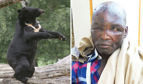 Photos: Man Survives Horrific Bear Attack