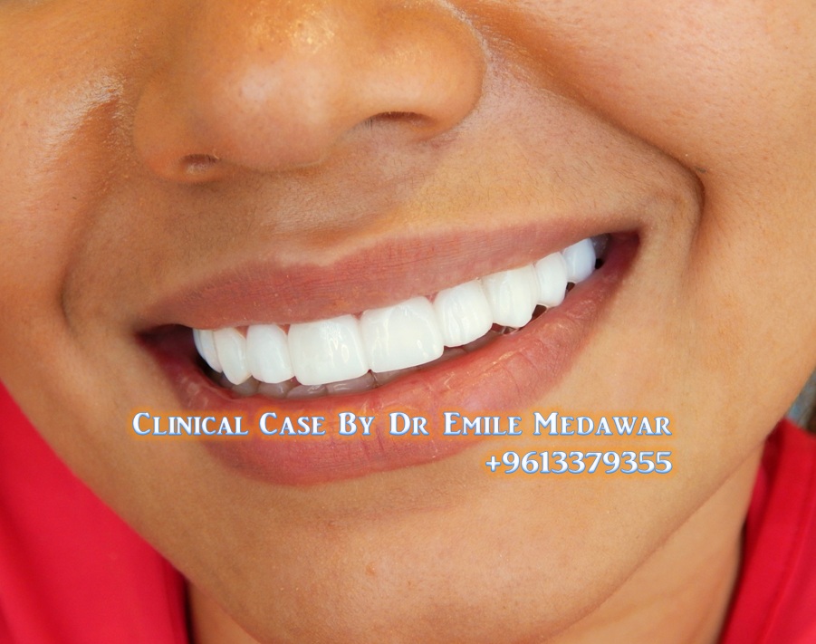 Hollywood Smile Perfection Lebanon: دكتور اميل مدوّر، طبيب أسنان ...