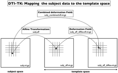 DTI Tutorial 2 - Normalization and Statistics | Diffusion Imaging; Introduction, tutorials and ...