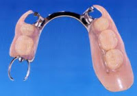 CLINICA MIMA: PRÓTESIS FLEXIBLE DENTAL