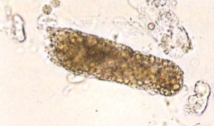 kimia klinik: Pemeriksaan sedimen urine