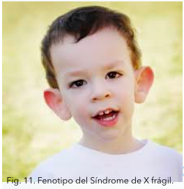 RED LATINOAMERICANA DE PEDIATRÍA Y NEONATOLOGÍA: Malformaciones ...