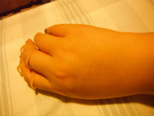 Amazin Arty Antics: Random Swollen Hand Pics