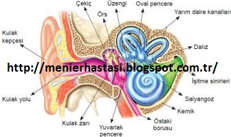 MENİER SENDROMU: Kulak Hastalıkları 3