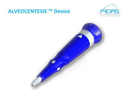 Блог стоматолога: Система Propel - новое устройство для ремоделирования ...