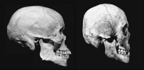 Aryan Anthropology: The Profile View