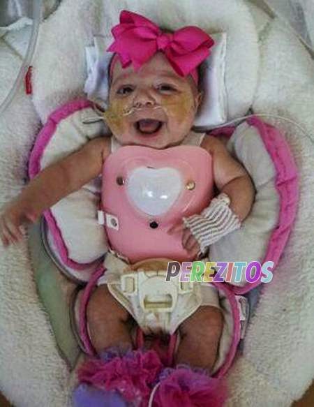 universoenfermo: Ectopia cordis