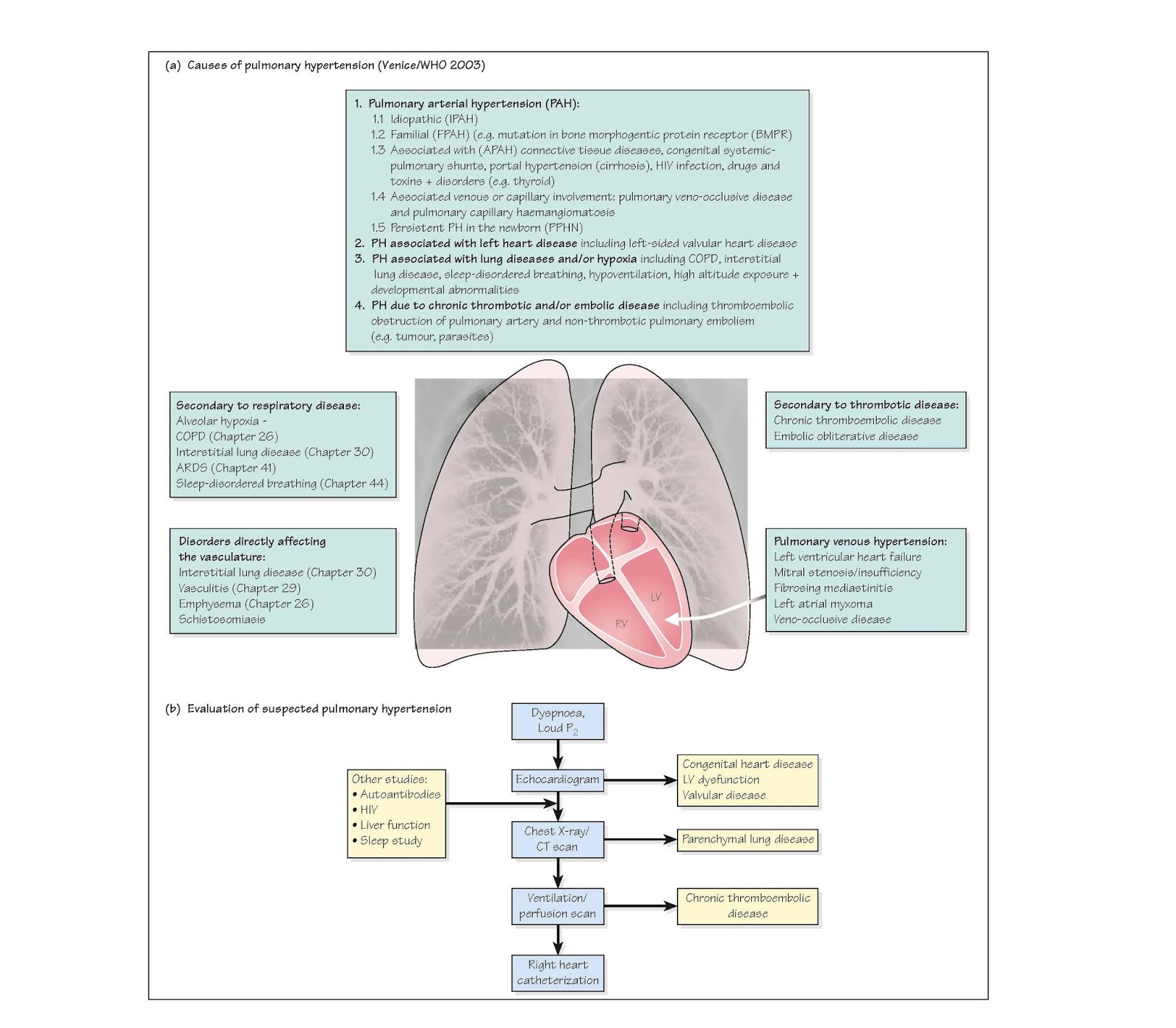 Pulmonary Hypertension - pediagenosis