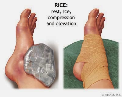 So Space: How to : Healing a broken foot