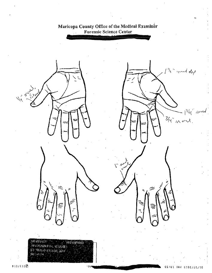 Morbitbuzz: Autopsy Report of Travis