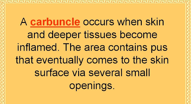 Carbuncle Pictures Causes Symptoms And Treatment