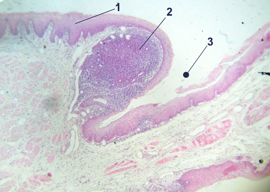 Histologia Oral UFF: Tonsila