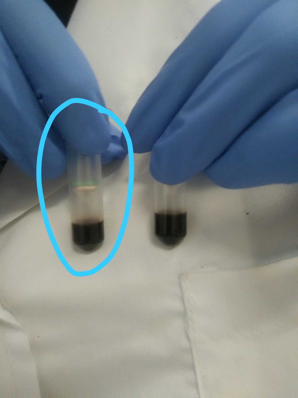 PRÁCTICA 13: EXTRACCIÓN DE ADN A PARTIR DE SANGRE TOTAL , BUFFY COAT Y ...