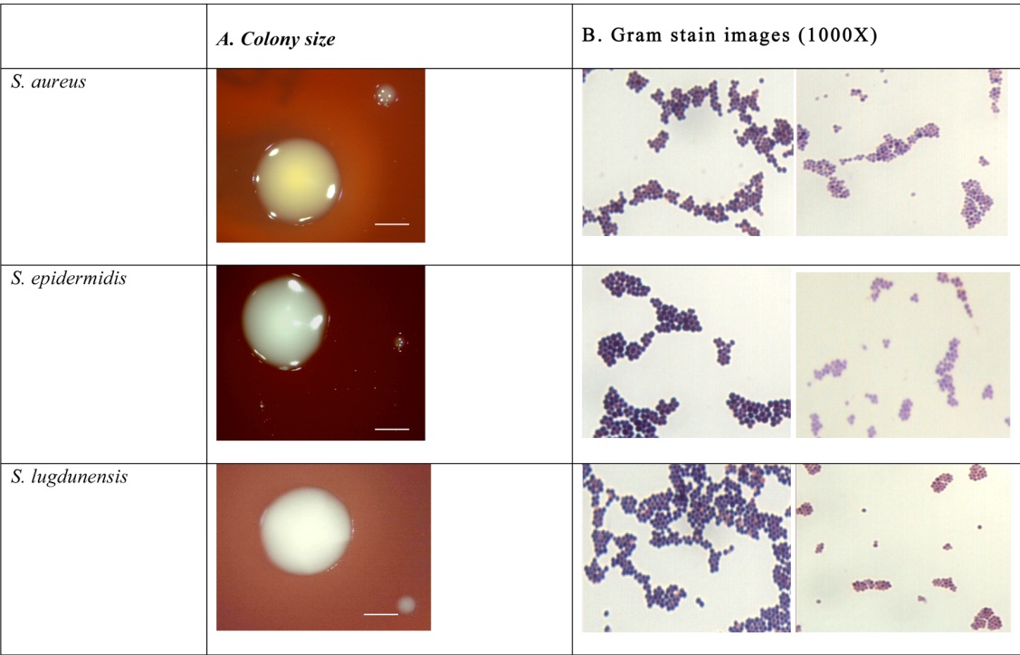 BLOG: Microbiología para Técnicos/as: Staphylococcus lugdunensis: el ...