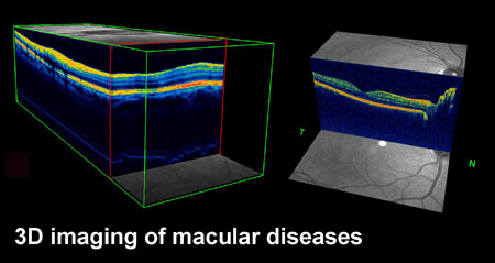 Mech Mecca: Optical coherence tomography