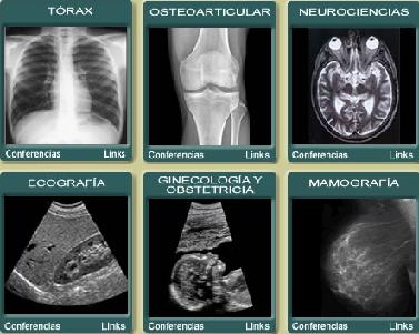 Técnicas diagnósticas: Los rayos-X: Aplicaciones de los rayos X.