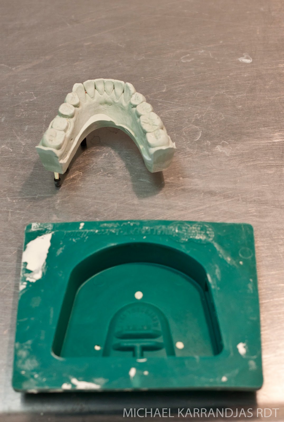 Dental Lab Model Fabrication | Making Noise And Drinking Beer