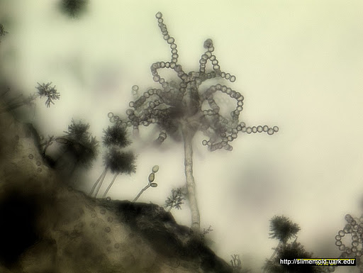 Kingdom Fungi and PhytoPathology - A Unique Perspective