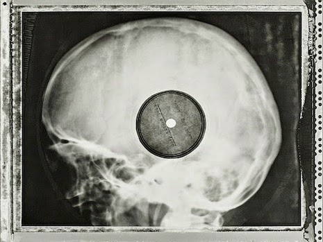 Arrowhead Vintage: Bone music: Soviet-era bootleg X-ray pressings