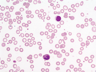 VETERINARY HEMATOLOGY DEXTERVET: Microcytic hypochromic red cells in ...