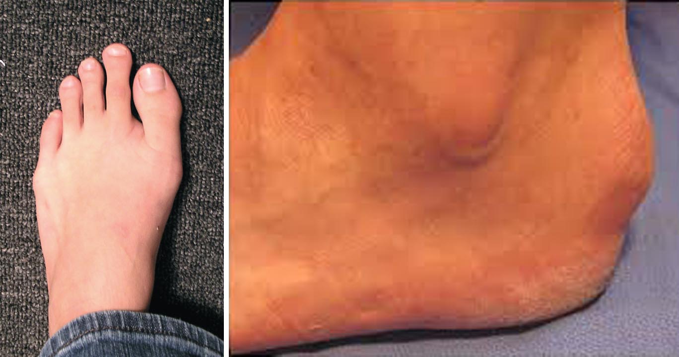 As Many Exceptions As Rules: Tough As Nails