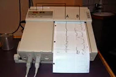 Fetal Monitor FC-700 Bionet - SURYA MEDILAB