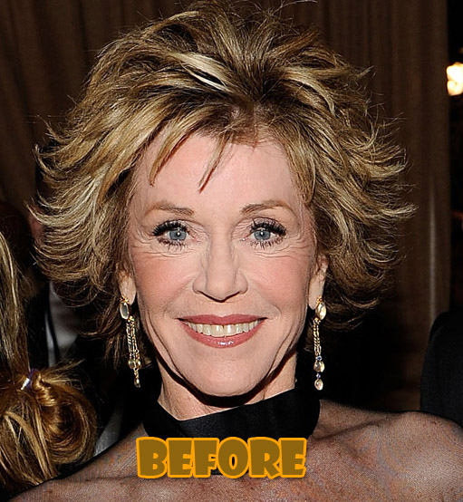Jane Fonda Plastic Surgery Before and After | Celebrity Plastic Surgery