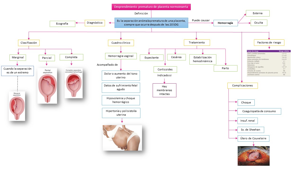 Exposición. Desprendimiento prematuro de placenta normoinserta (DPPNI ...