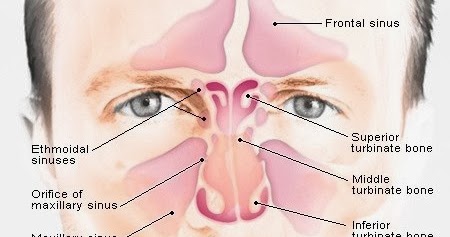 Sinusitis : Gejala, Penyebab Dan Pengobatannya - ARSIP INFO