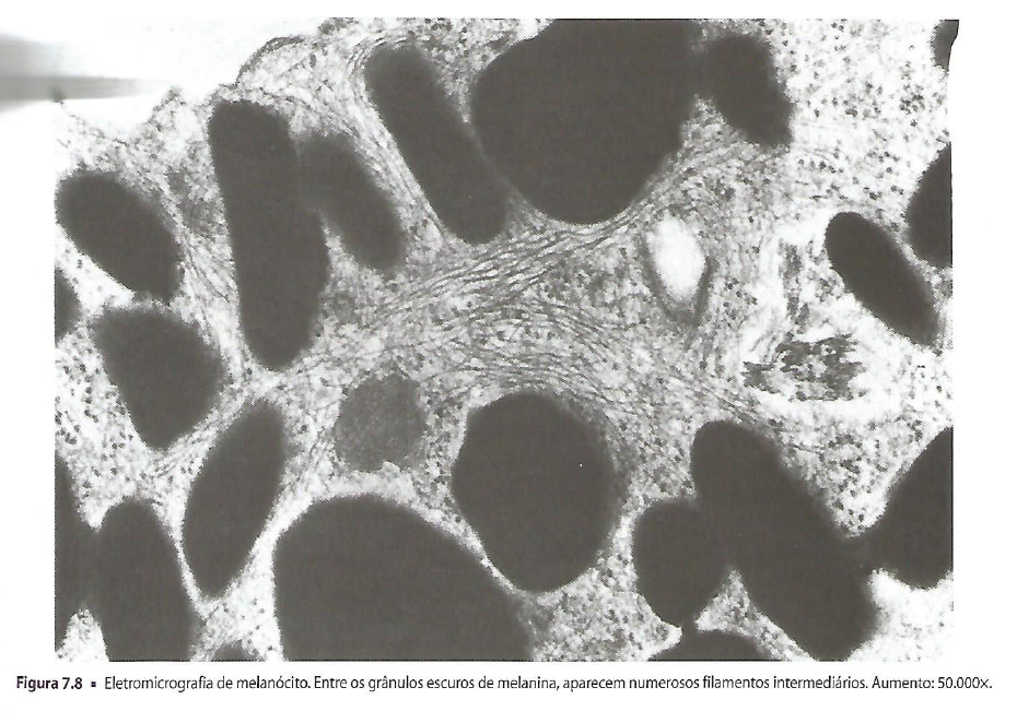 Filamentos intermediários