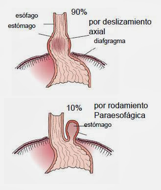 Patologia B: ESOFAGO. ANOMALIAS CONGENITAS-INFLAMACION-LESIONES ...