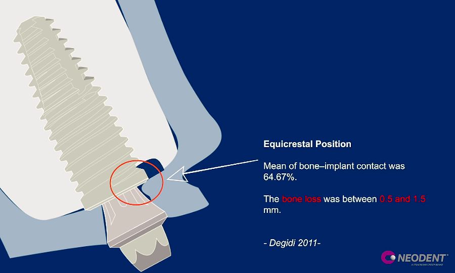 IMPLANTOLOGY: Crestal vs Subcrestal position - Neodent