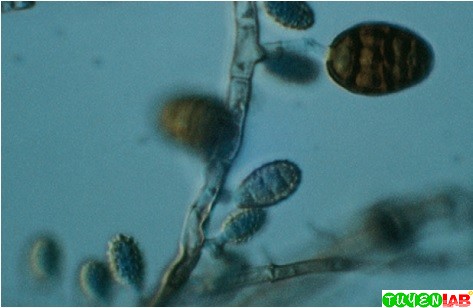 [Parasitology] Atlas of Medically Significant Fungi | Free Medical Atlas