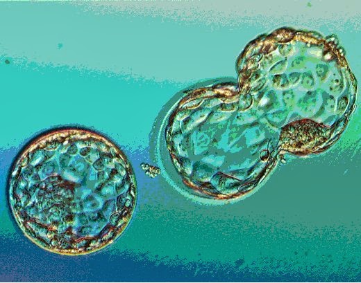 Embryo For Life: Aprendendo a Classificação dos Embriões