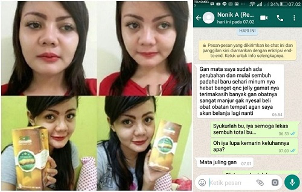 Cara Mencegah Mata Juling Pada Anak Usia 6 Tahun 100% Tanpa Operasi ...