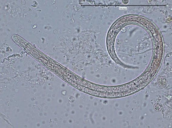 Fun With Microbiology (What's Buggin' You?): Strongyloides stercoralis ...