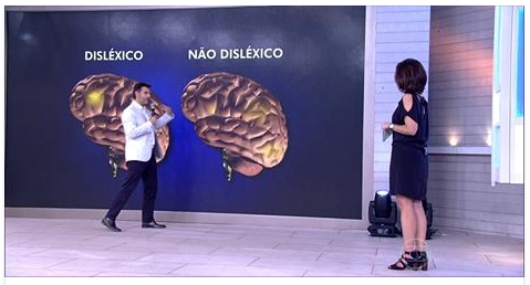 Aprender Especial: Como funciona o cérebro de um Disléxico