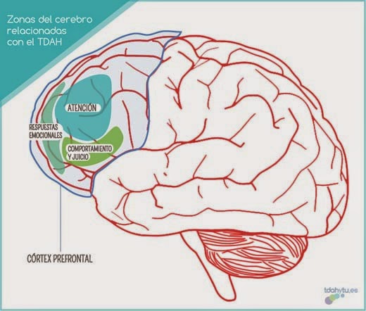 “El TDAH”: FACTORES RELACIONADOS CON EL TDAH