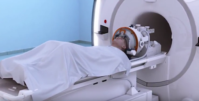 Our Parkinson's Place: MRI-guided focused ultrasound effective to treat ...