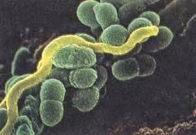 Streptococcus mutans Penyebab Karies Gigi - Biologi Edukasi: Belajar ...