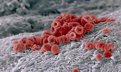 Medical Laboratory and Biomedical Science: Red blood cells