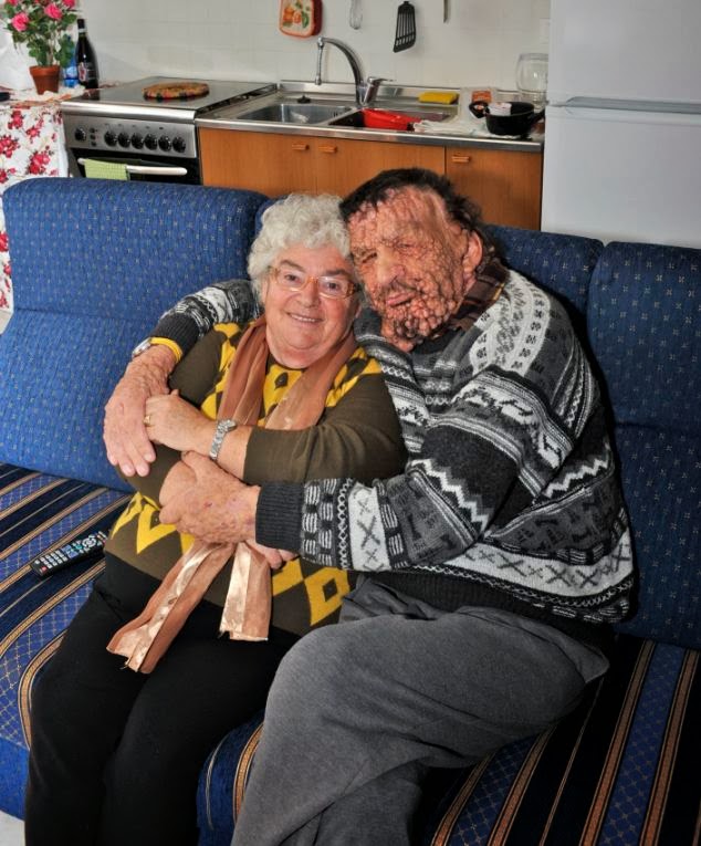 Manny360: [FULL PHOTOS] Disfigured Man who was Held and Kissed by Pope ...