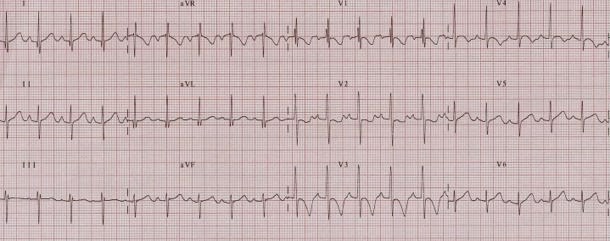 ER goldbook: Congenital heart disease III: Congestive heart failure