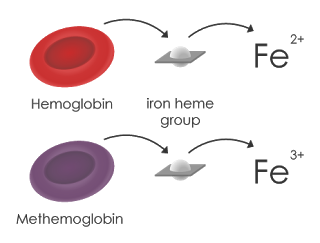 Methemoglobineamia - Blue Skin