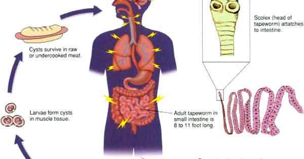 Bahaya Cacing Daging Babi Masuk ke Otak