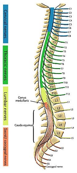 Spinal Neurinoma