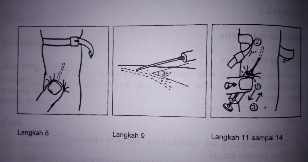 Apoteker Peduli: Cara Injeksi Intravena Yang Benar