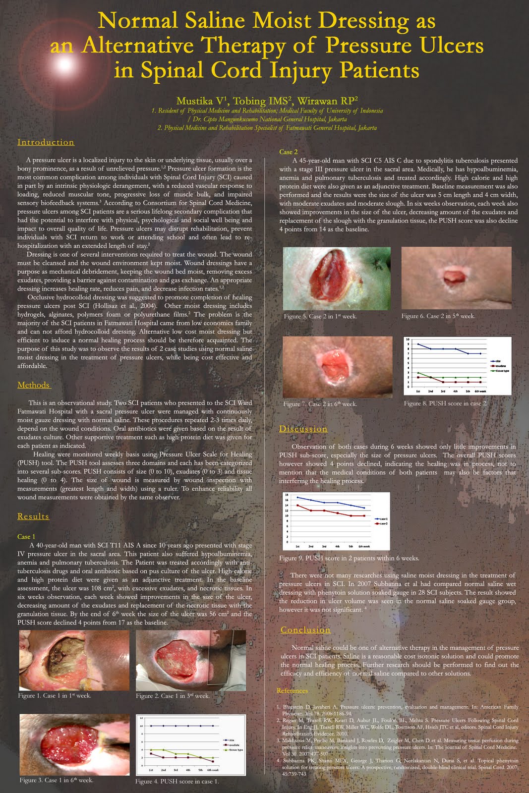 vanda mustika: Normal Saline Moist Dressing as an Alternative Therapy ...